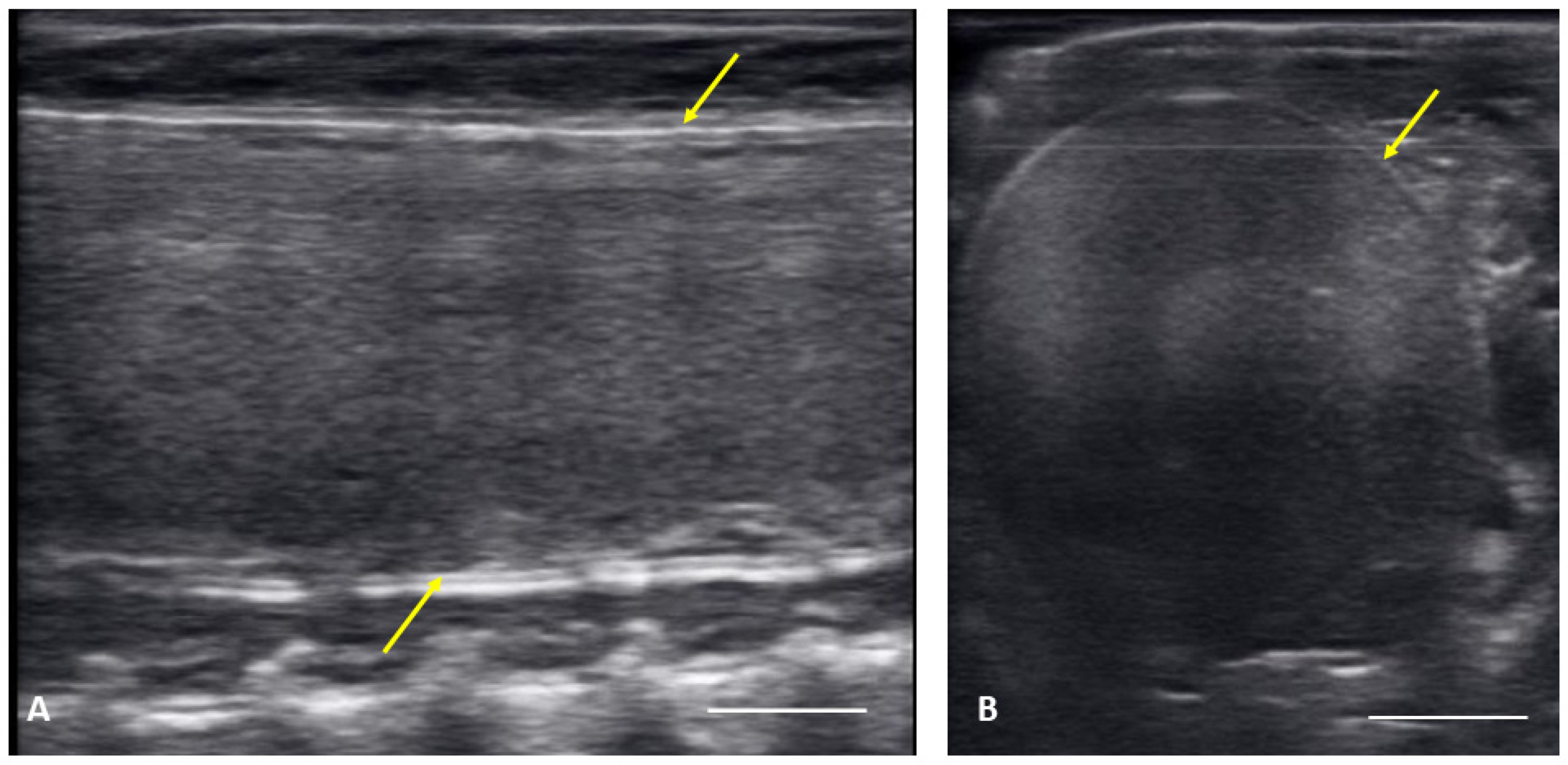 Ultrasound Description of Follicular Development in the Louisiana ...