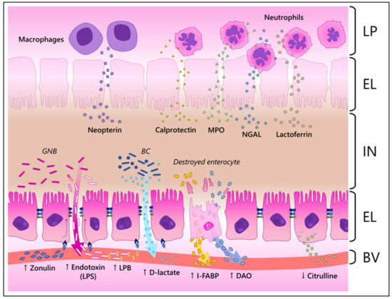 Morphological Assessment and Biomarkers of Low-Grade, Chronic ...