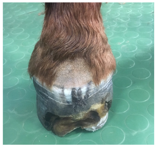 From Keratoma to Anaplastic Malignant Melanoma in a Horse’s Hoof