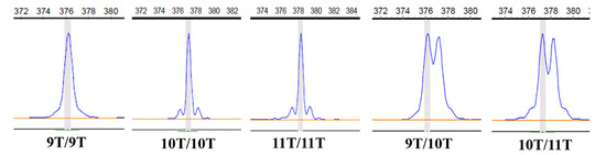 A Poly(dA:dT) Tract in the IGF1 Gene Is a Genetic Marker for Growth ...