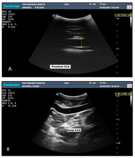 A Preliminary Study on the Siphon Mechanism in Giraffe (Giraffa ...