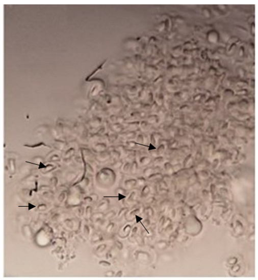 Bacillus subtilis Effects on Growth Performance and Health Status of ...