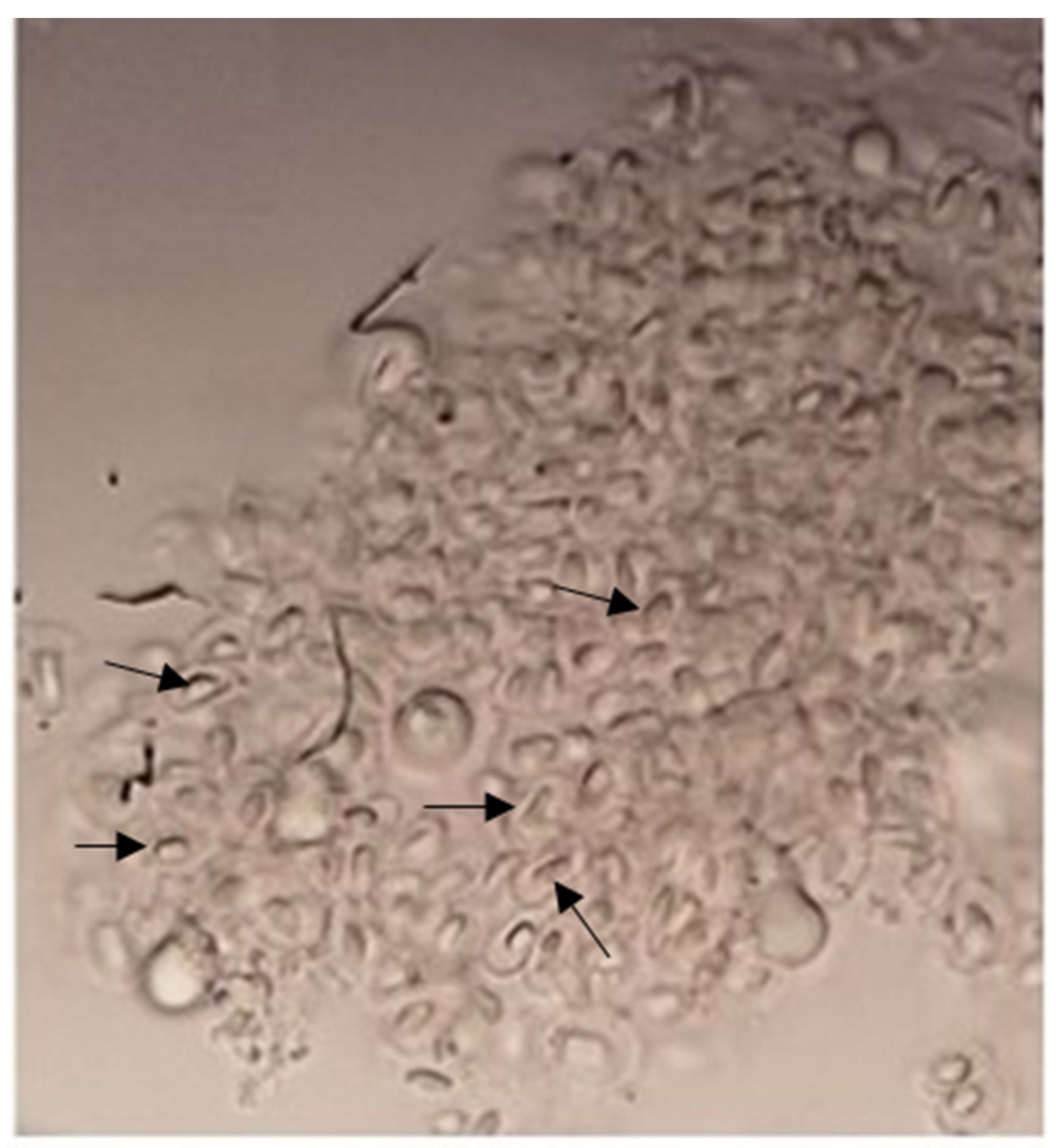 Bacillus subtilis Effects on Growth Performance and Health Status of ...