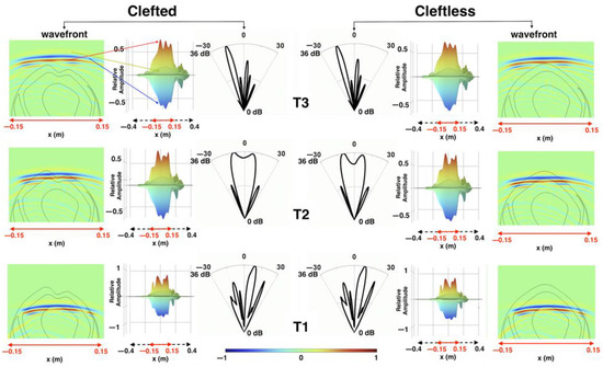 The Distinctive Forehead Cleft of the Risso’s Dolphin (Grampus griseus ...