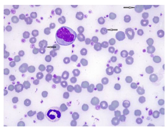 A Case Study of Photosensitivity Associated with Anaplasma spp ...