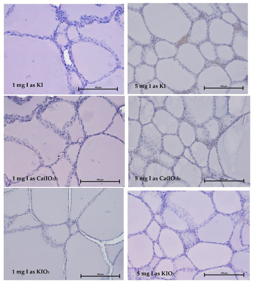 The Thyroid Hormone and Immunoglobulin Concentrations in Blood Serum ...