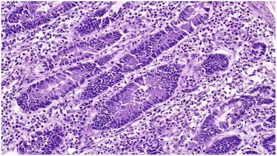 Diagnostic Approach to Enteric Disorders in Pigs
