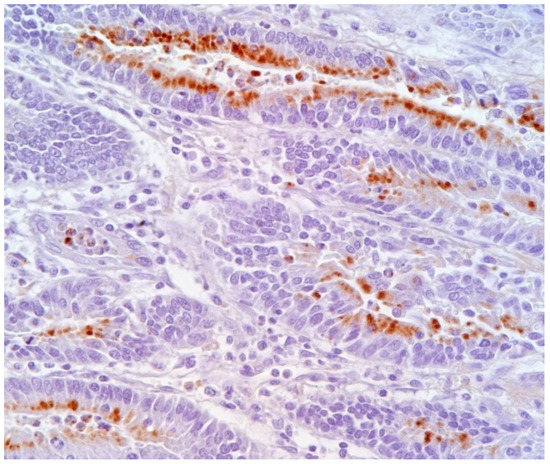 Diagnostic Approach to Enteric Disorders in Pigs