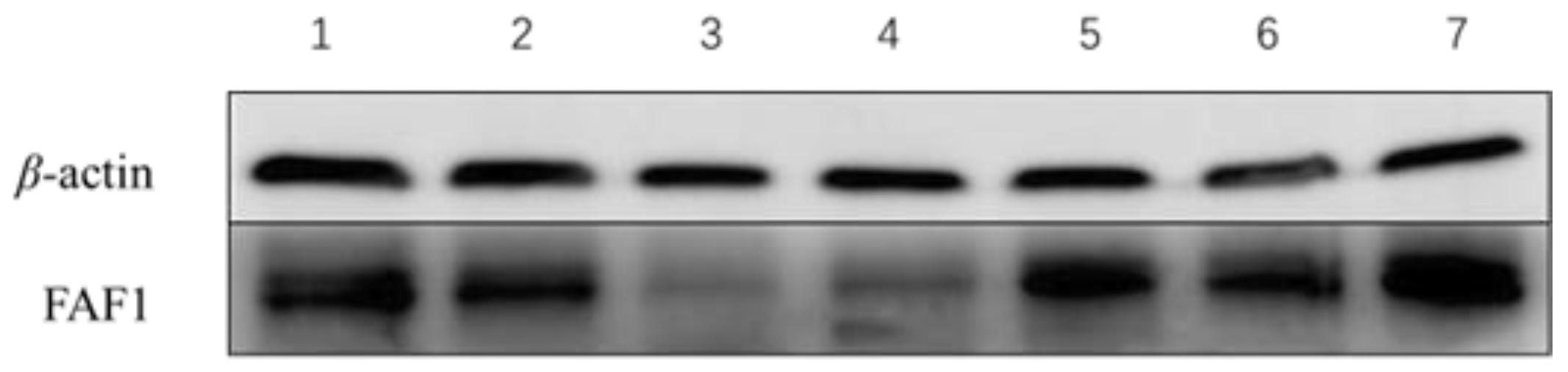 Expression and Localization of Fas-Associated Factor 1 in Testicular ...