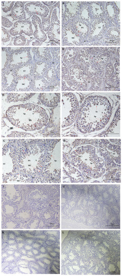 Expression and Localization of Fas-Associated Factor 1 in Testicular ...