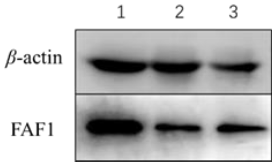 Expression and Localization of Fas-Associated Factor 1 in Testicular ...