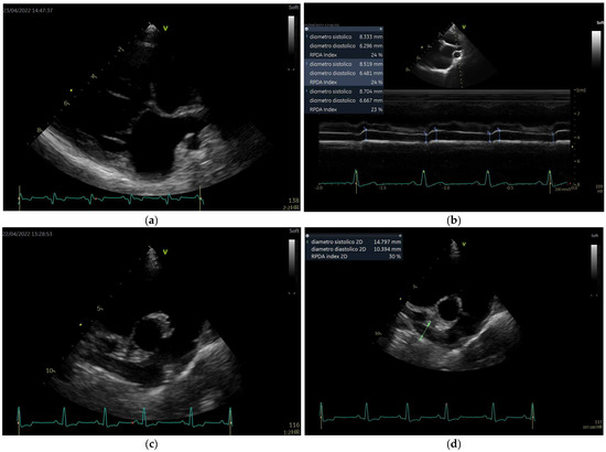 Right Pulmonary Artery Distensibility Index in Heartworm Infected Dogs ...