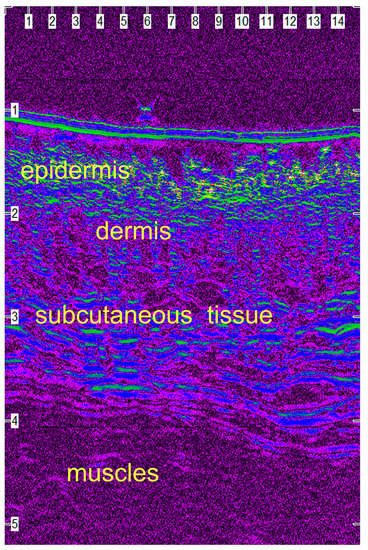 Evaluation of Incisional Wound Healing in Dogs after Closure with ...