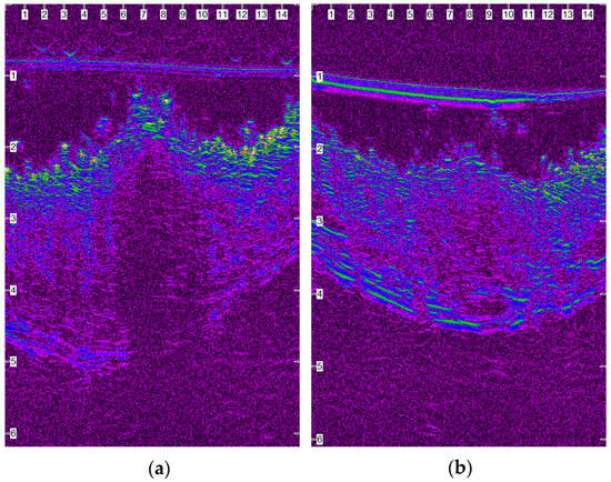 Evaluation of Incisional Wound Healing in Dogs after Closure with ...