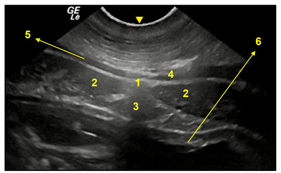 Surgical Anatomy for Sterilization Procedures in Female Capybaras