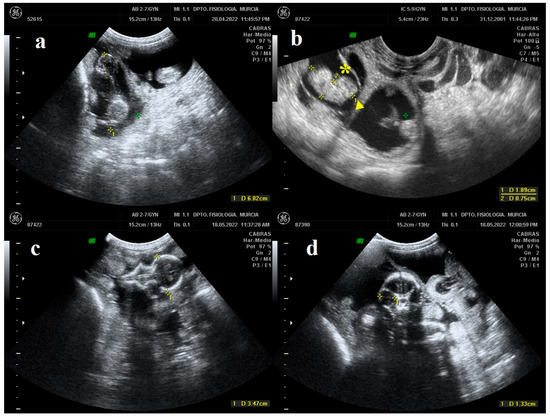 Animals | Free Full-Text | Ultrasonography of Pregnancy in Murciano ...