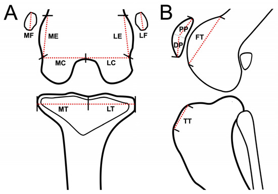 Comparison of Digital Radiography, Computed Tomography, and Magnetic ...