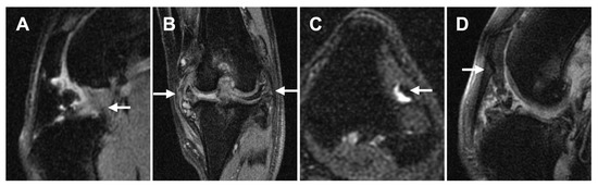 Comparison of Digital Radiography, Computed Tomography, and Magnetic ...