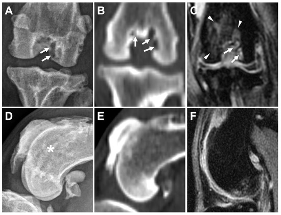 Comparison of Digital Radiography, Computed Tomography, and Magnetic ...