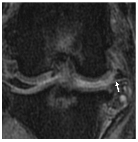 Comparison of Digital Radiography, Computed Tomography, and Magnetic ...