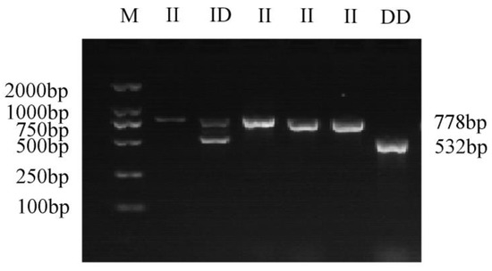 The Novel Structural Variation in the GHR Gene Is Associated with ...