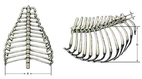 Two Types of Management for the Noninvasive Treatment of Pectus ...