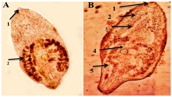 Prevalence and Morphological Investigation of Parasitic Infection in ...