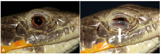Anatomy, Physiology, and Disorders of the Spectacle, Subspectacular ...