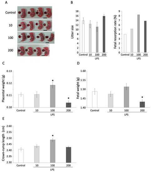 LPS Administration during Fertilization Affects Epigenetic Inheritance ...