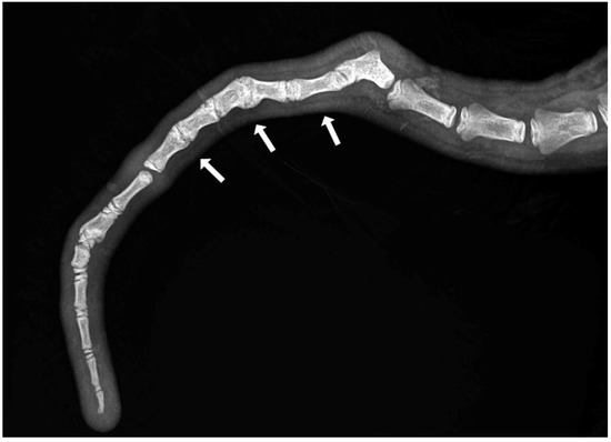 Frequency and Characterisation of Anomalies and Fractures of the Caudal ...