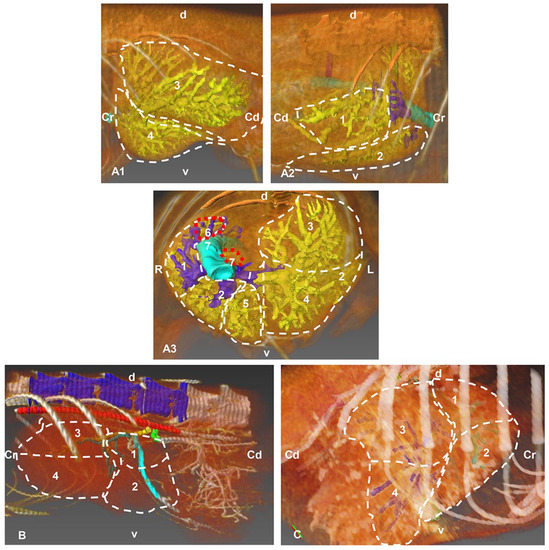 Creation of Three-Dimensional Anatomical Vascular and Biliary Models ...