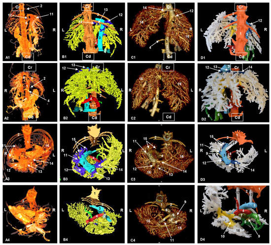 Creation of Three-Dimensional Anatomical Vascular and Biliary Models ...