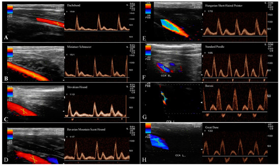 Ultrasound Evaluation of Extracranial Cerebral Circulation (The Common ...