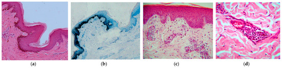 Leucoderma in Buffaloes (Bubalus bubalis) in the Amazon Biome