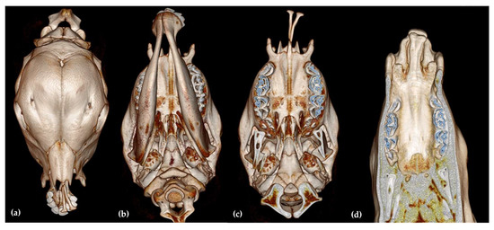 Simultaneous Occurrence of Hypospadias and Bilateral Cleft Lip and Jaw ...