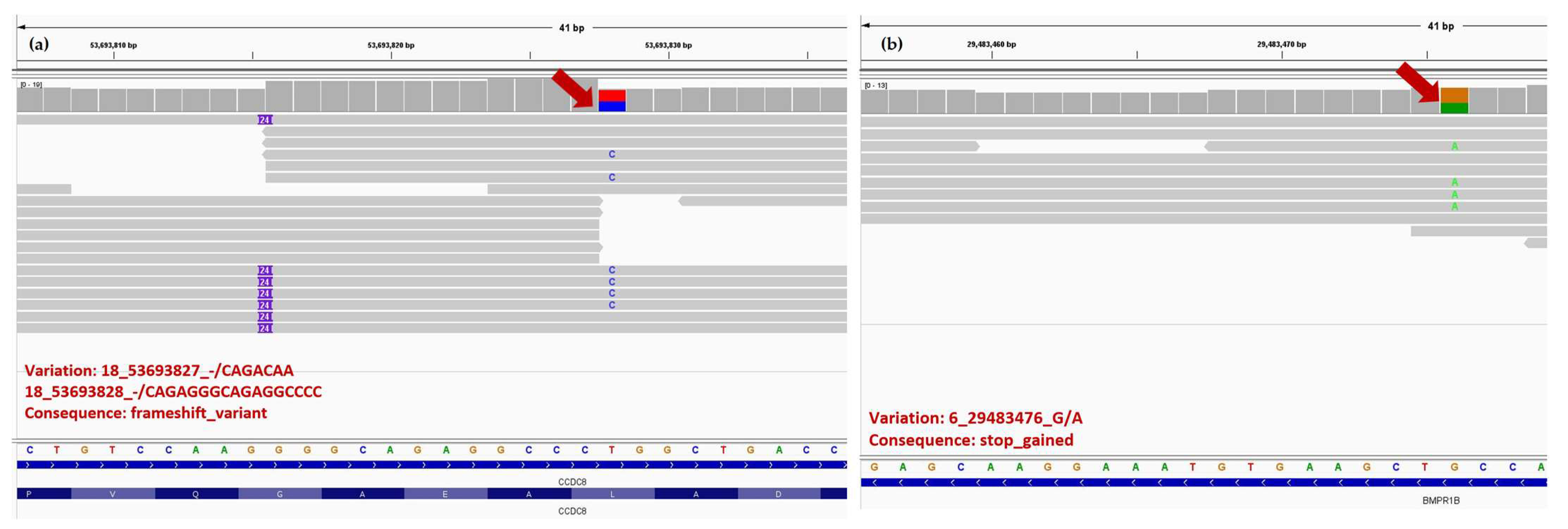 Simultaneous Occurrence of Hypospadias and Bilateral Cleft Lip and Jaw ...