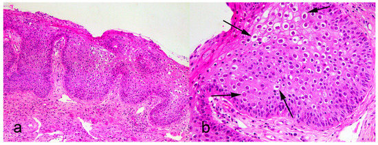 Genomic Characterization of Canis Familiaris Papillomavirus Type 25, a ...