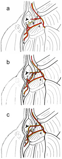 Anatomic Variations of the Perineal Arteries and Nerves in the Male and ...