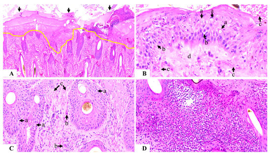 The Development of Cutaneous Lesions in Tropically Adapted Beef Cattle ...