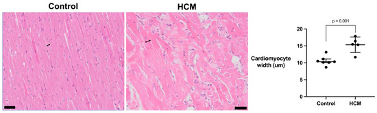 Exploration of Mediators Associated with Myocardial Remodelling in ...