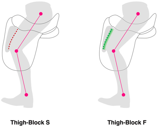 Saddle Thigh Block Design Can Influence Rider and Horse Biomechanics