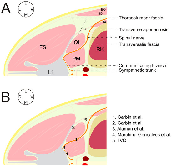 An Ultrasound-Guided Latero-Ventral Approach to Perform the Quadratus ...
