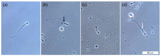 Impaired Testicular Function without Altering Testosterone ...