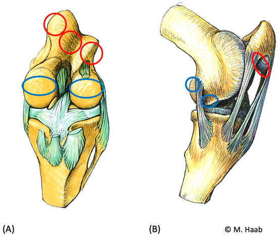 Diagnostic Performance of Multi-Detector Computed Tomography ...
