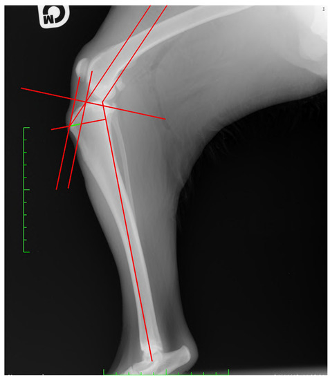Comparison of Two Preoperative Radiographic Methods for Assessing ...