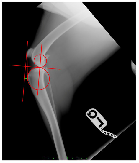 Comparison of Two Preoperative Radiographic Methods for Assessing ...