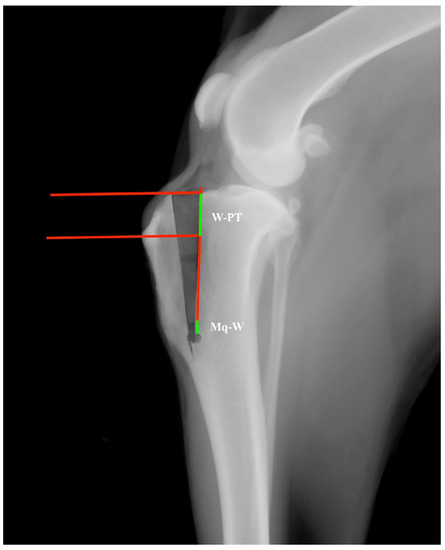 Comparison of Two Preoperative Radiographic Methods for Assessing ...
