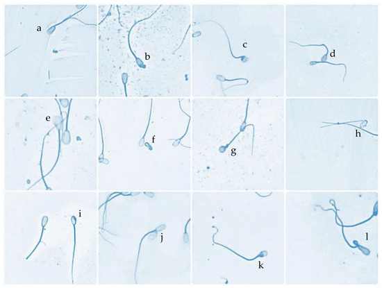Animals | Free Full-Text | Sperm Head Morphology Alterations Associated ...