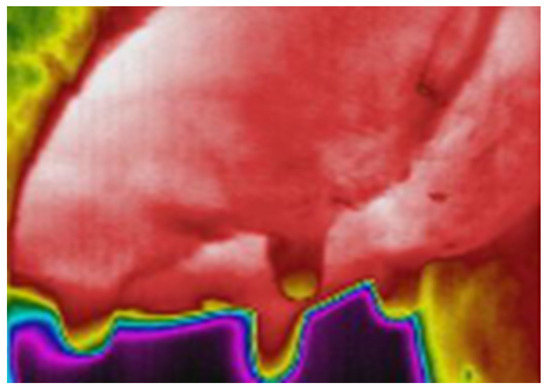 Mastitis in Dairy Cattle: On-Farm Diagnostics and Future Perspectives