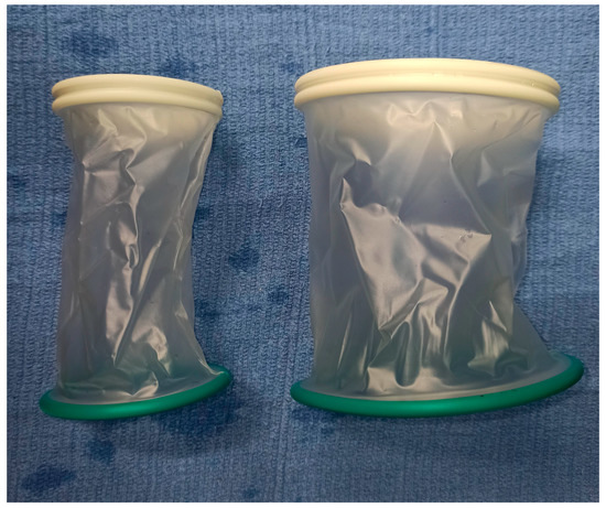 Double-Wound O-Ring Retraction for Chylothorax Surgery in Dogs